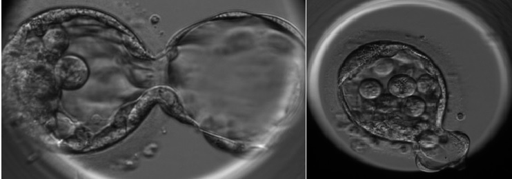 Memorial Şişli Tüp Bebek Merkezi / AYIN KONUSU / Öploid embriyoda ...